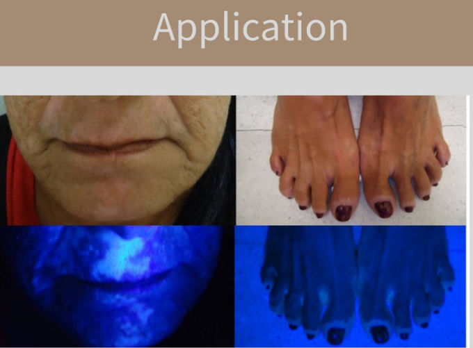 Woods Lamp Skin Examination Veterinary 9000C Kernel Medical Equipment