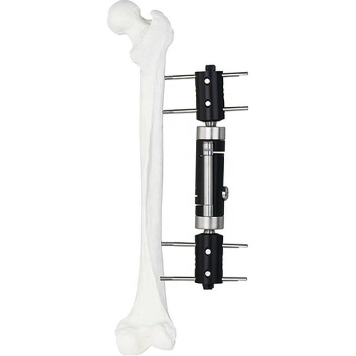 Orthopedic Medical Implant Straight Type External Fixator Ex Fix Device