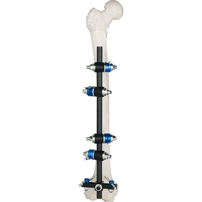 Femur Tibial External Fixator